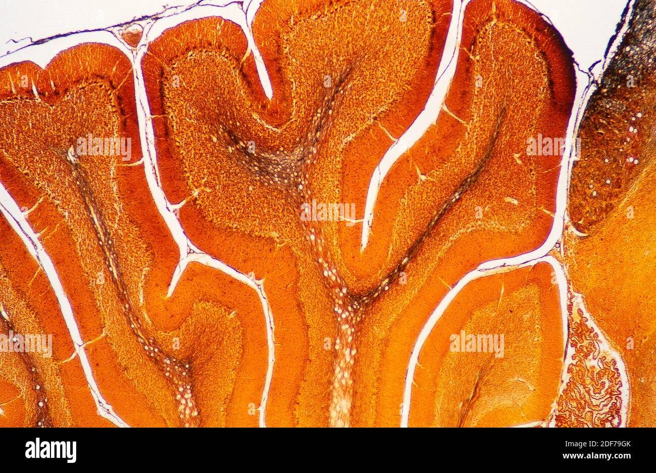 Brain tissue histology hi-res stock photography and images - Alamy
