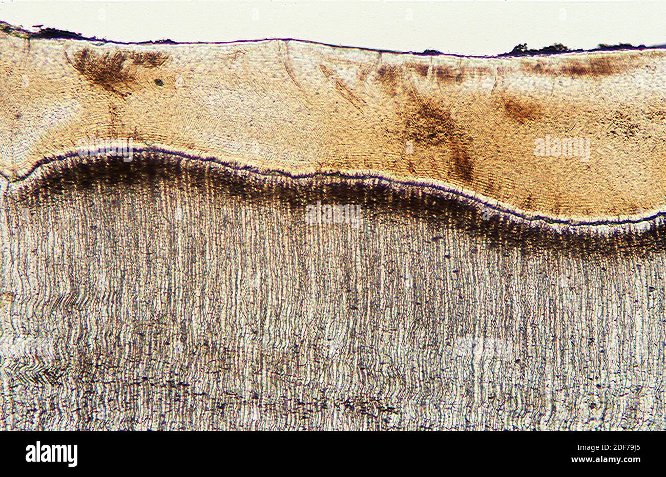 Dentin hi-res stock photography and images - Alamy