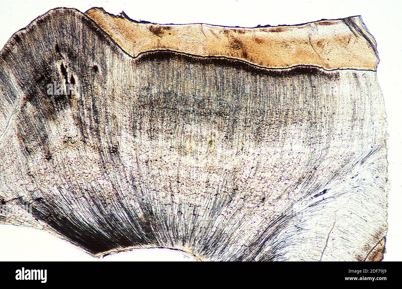 Dentin hi-res stock photography and images - Alamy