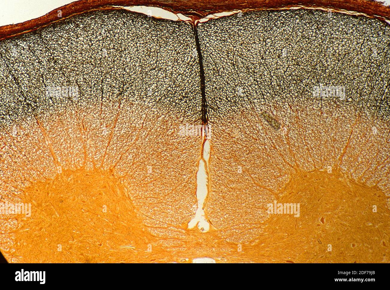 Spinal cord section micrograph hi-res stock photography and images - Alamy