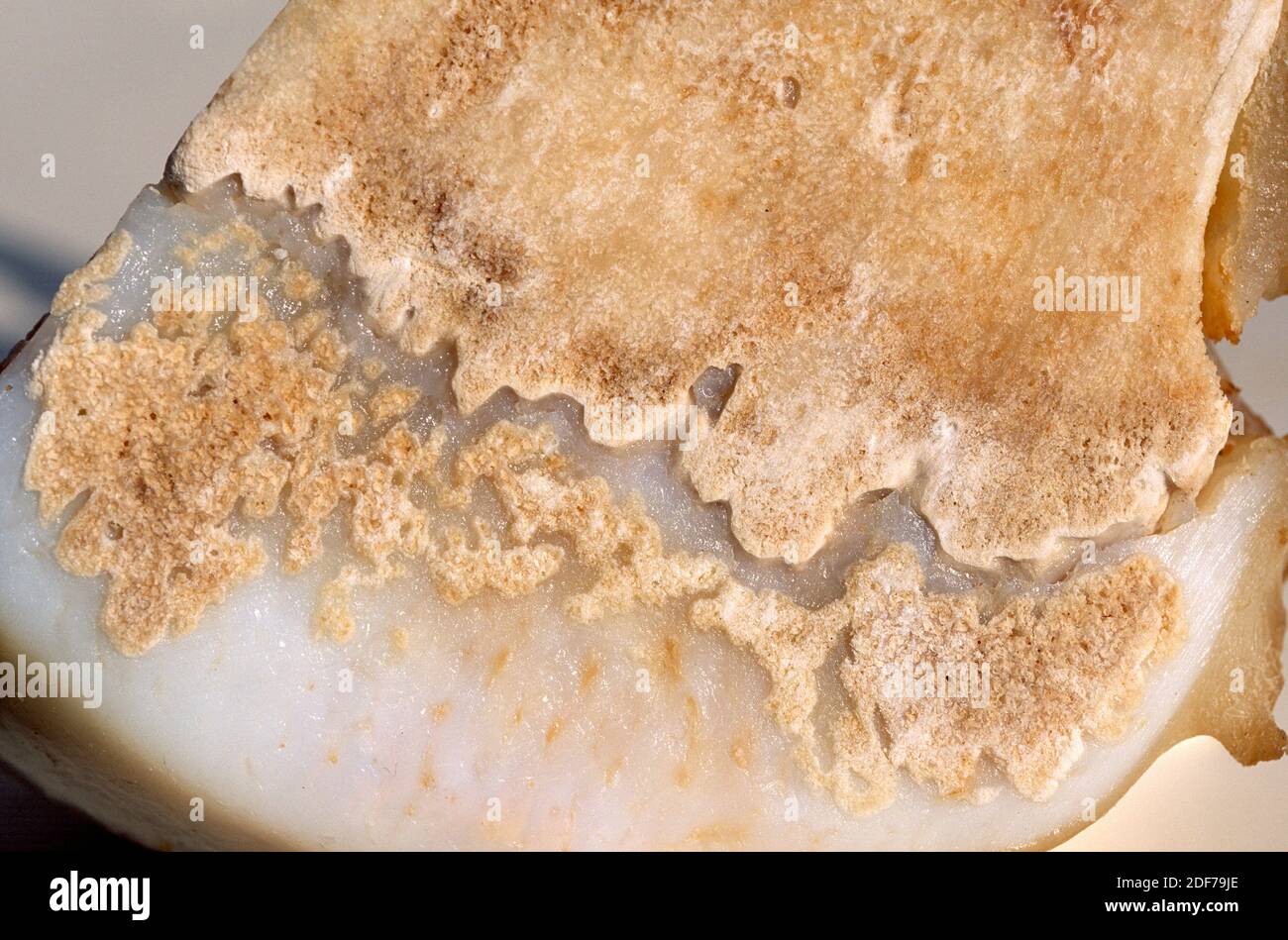 Longitudinal Section Of Bone High Resolution Stock Photography and ...