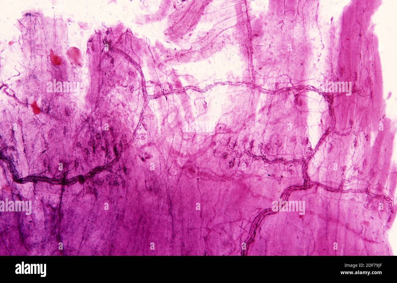 Motor neuron micrograph hi-res stock photography and images - Alamy