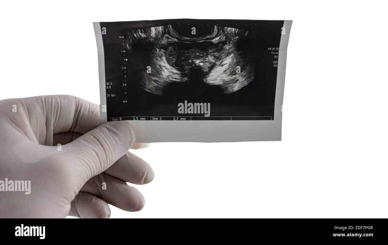 The male prostate in the picture is isolated on a white background ...