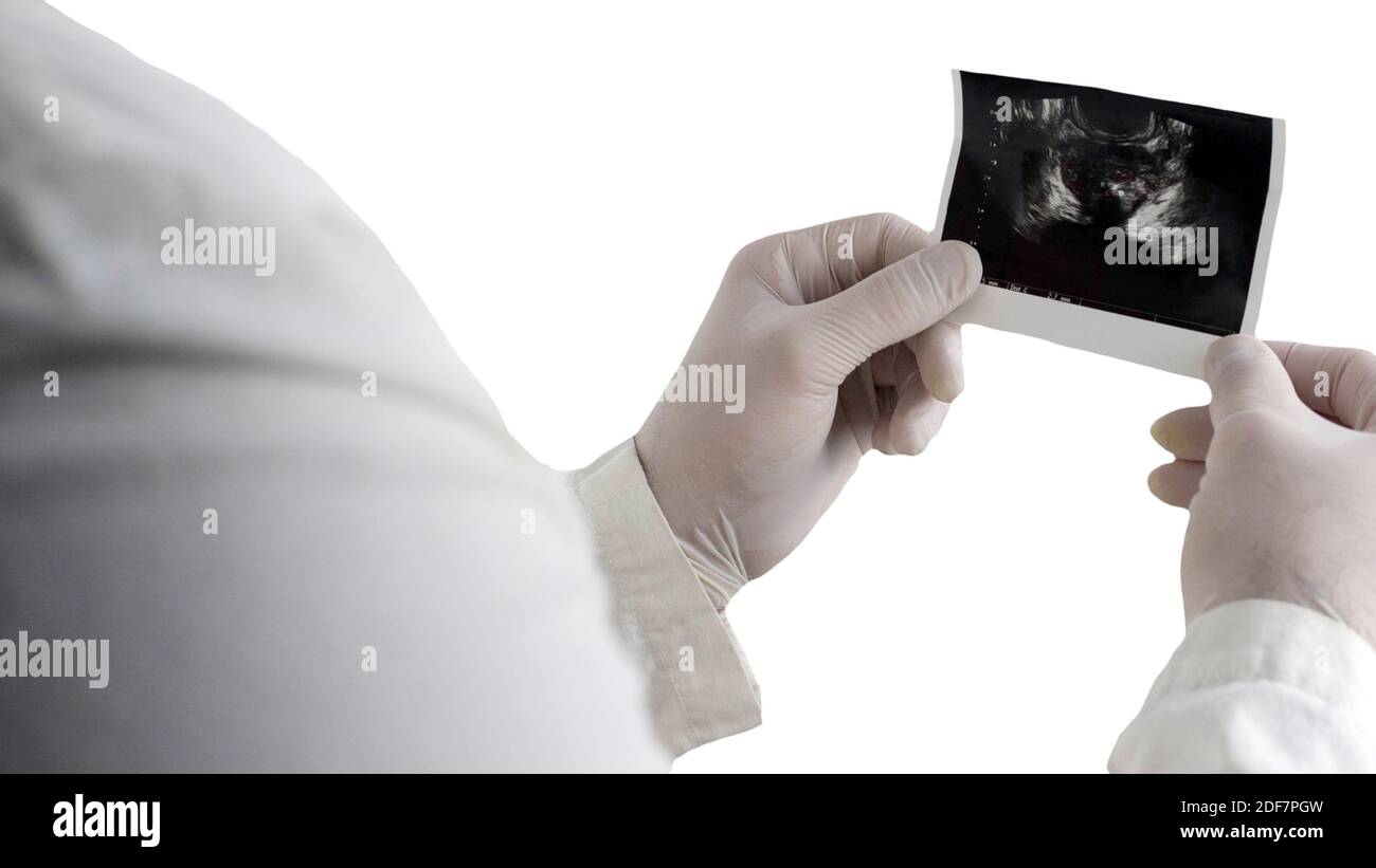 Shot of male prostate on white isolated background, place for text ...