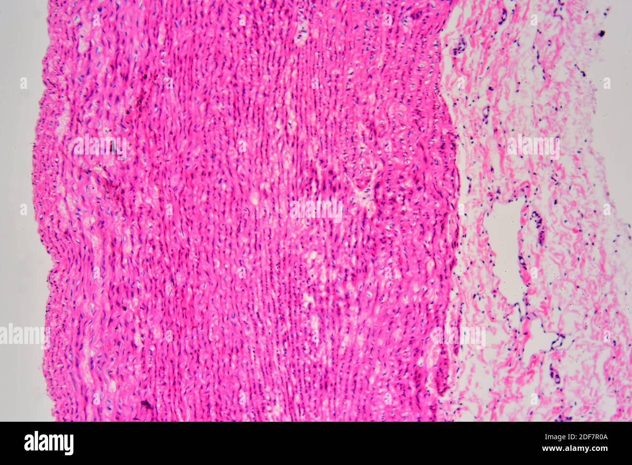 Muscle Fibers Cross Section High Resolution Stock Photography and ...