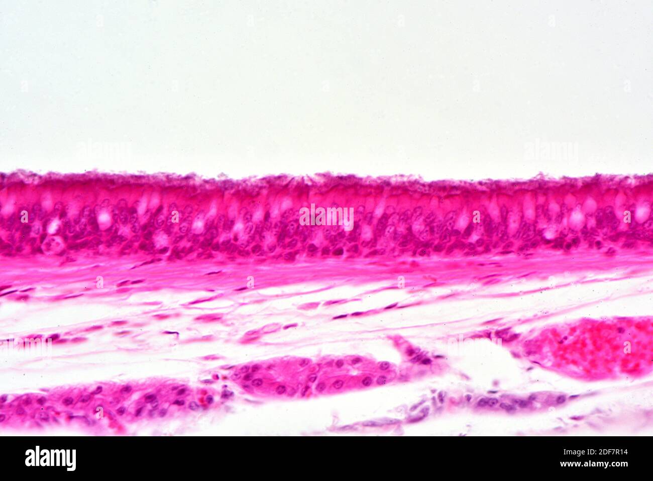 Pseudostratified Ciliated Columnar Epithelium