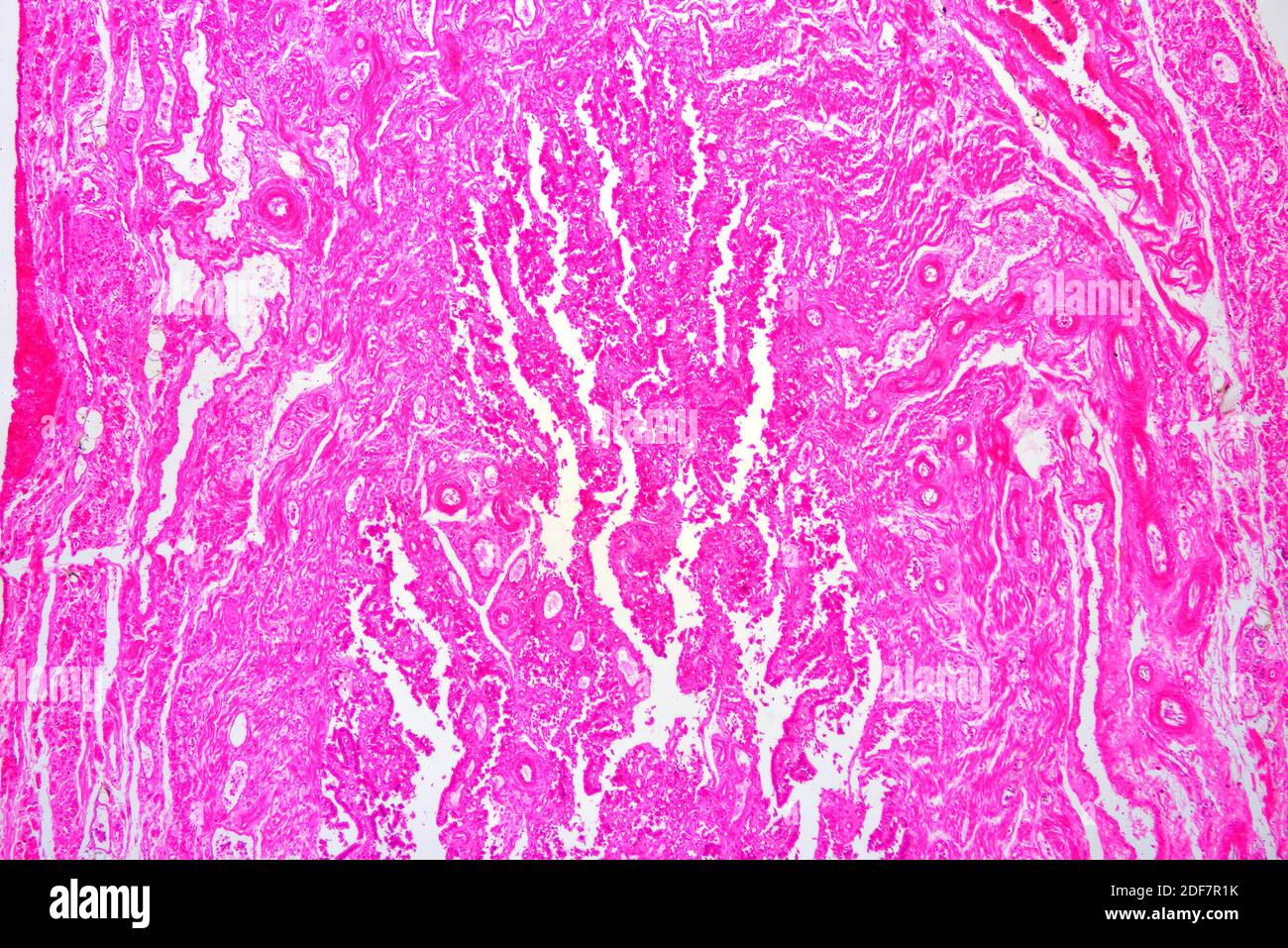 Fallopian tube hi-res stock photography and images - Alamy