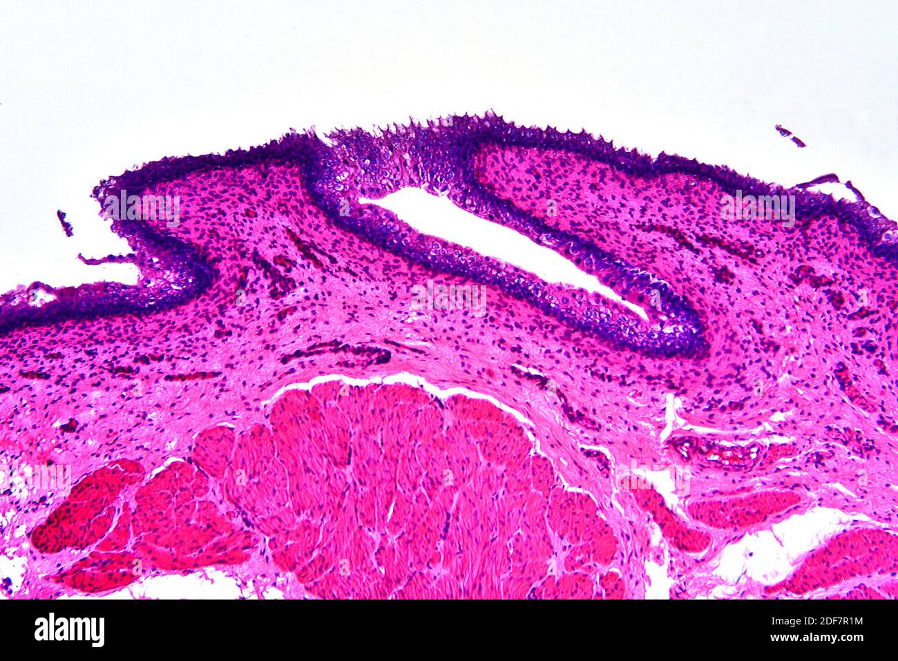 Transitional epithelium hi-res stock photography and images - Alamy