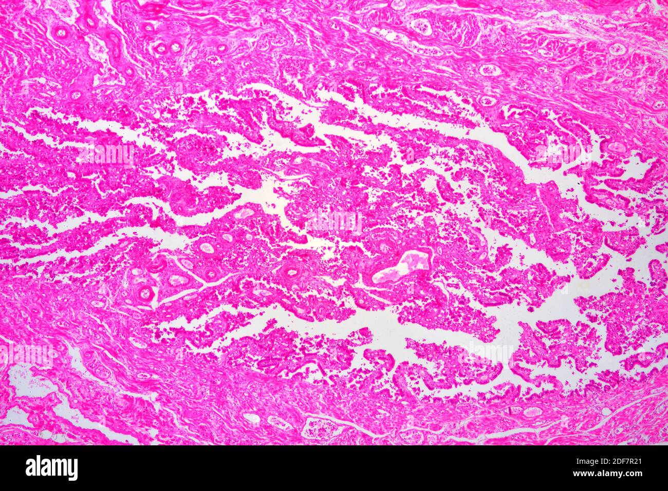 Fallopian tube hi-res stock photography and images - Alamy