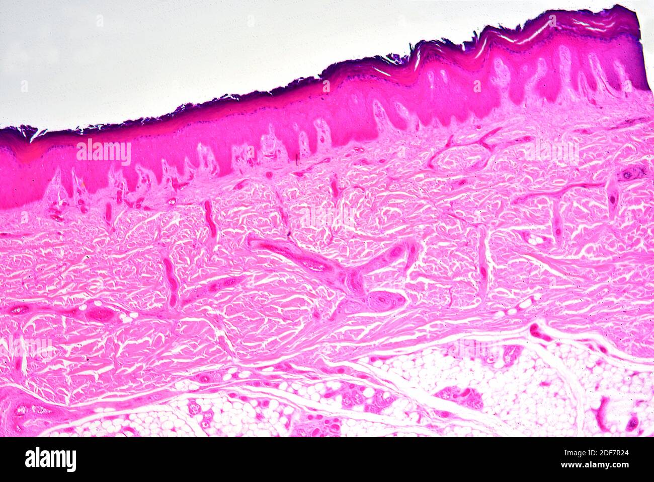 Keratinized Stratified Squamous Epithelium Skin Keratinized Stratified Squamous Epithelium Skin