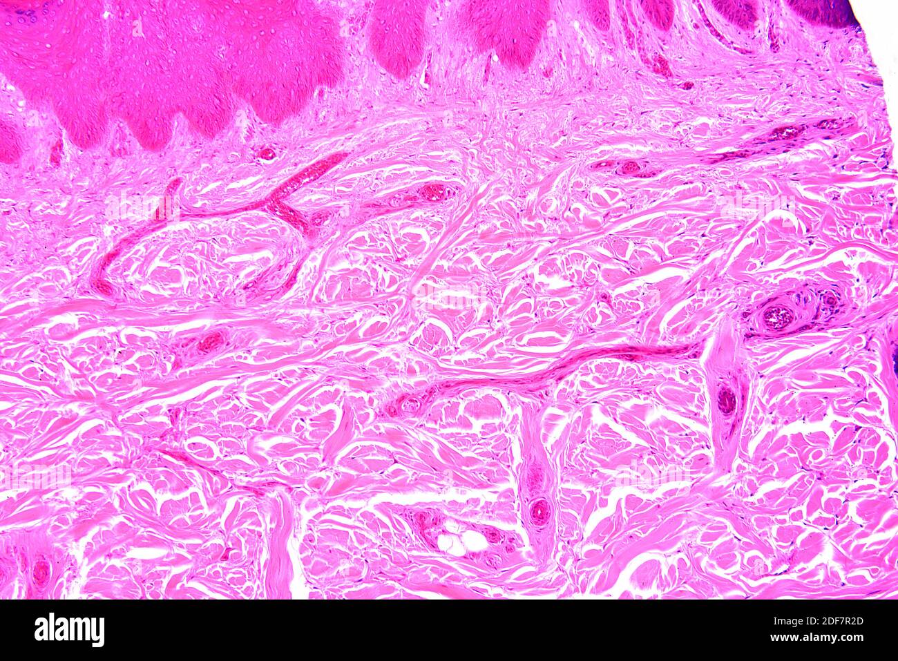 Epidermal Tissue Human