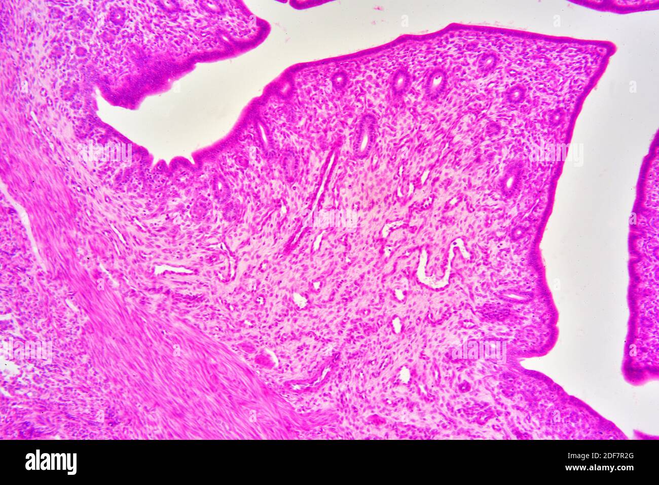 Cervix hi-res stock photography and images - Alamy