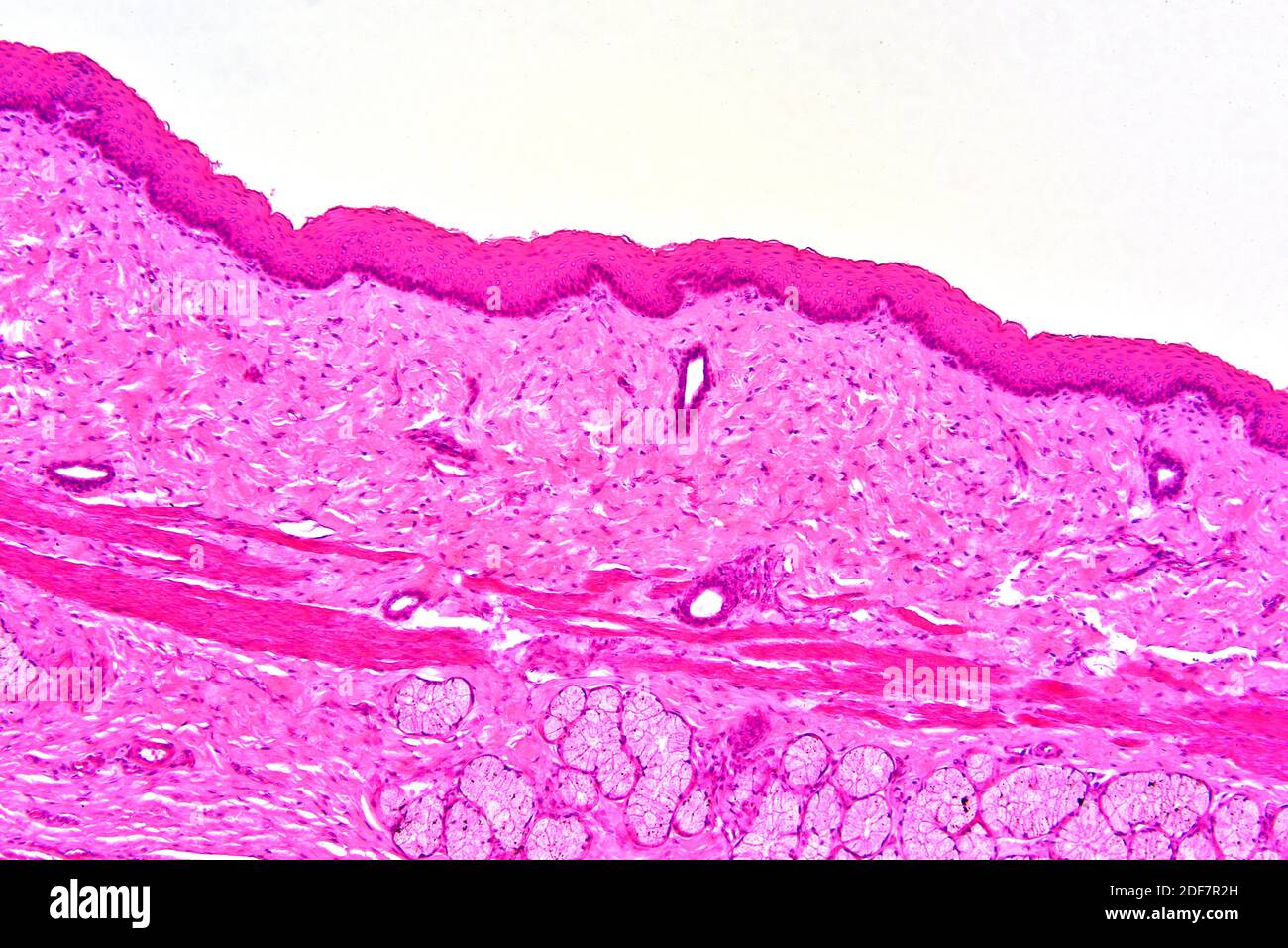 Squamous epithelium light micrograph hi-res stock photography and ...