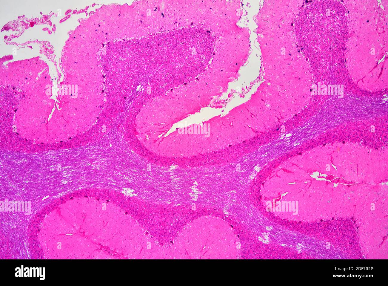 Cortex cerebellum hi-res stock photography and images - Alamy