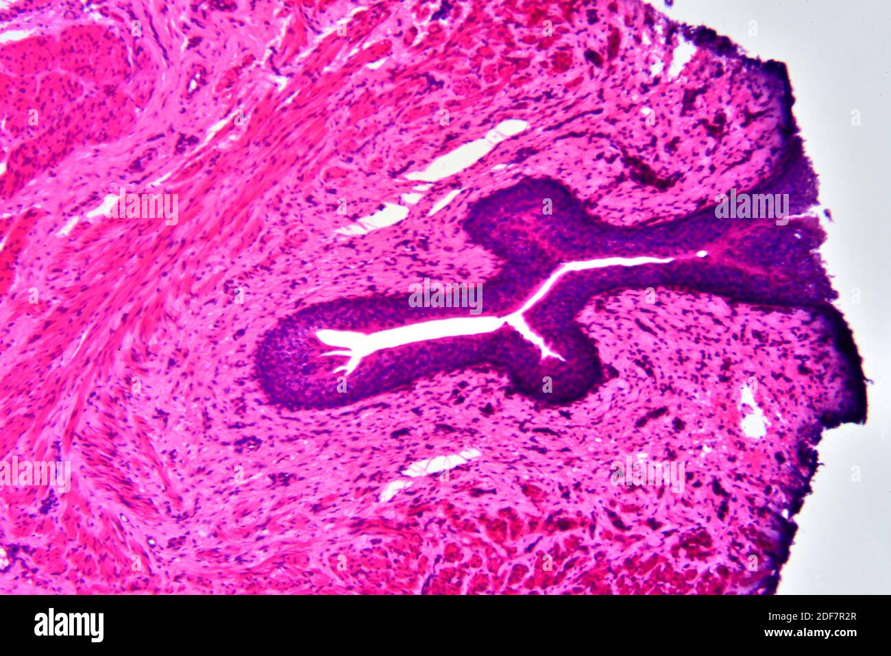 Transitional Epithelium High Resolution Stock Photography and Images ...