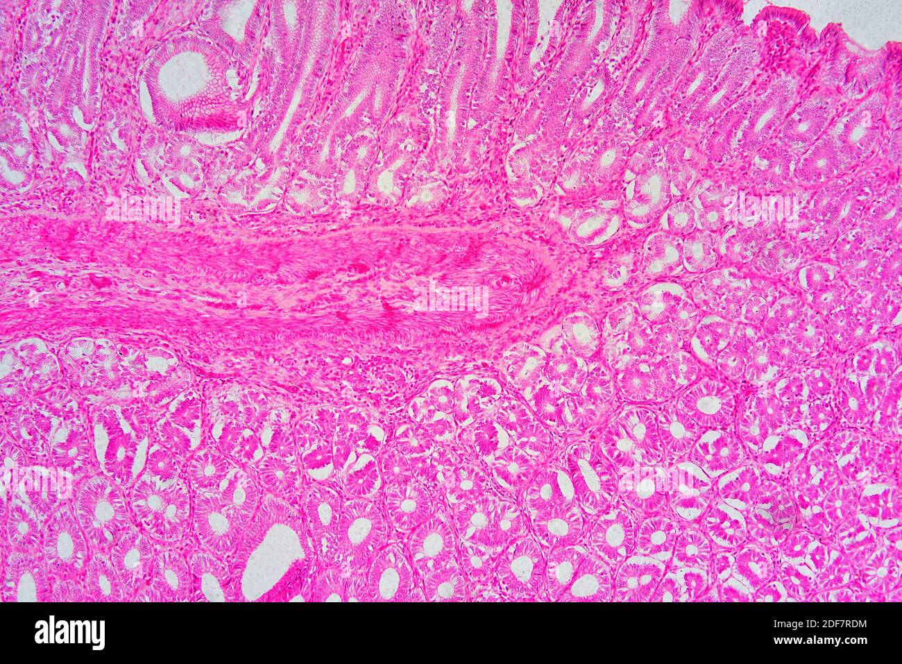 Stomach histology hi-res stock photography and images - Alamy