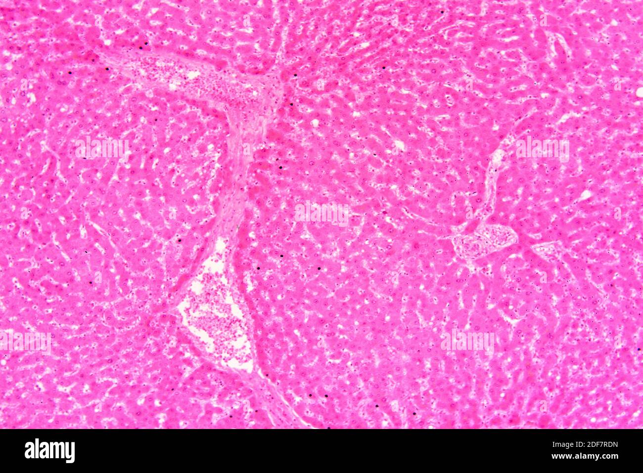 Human liver micrograph healthy hi-res stock photography and images - Alamy