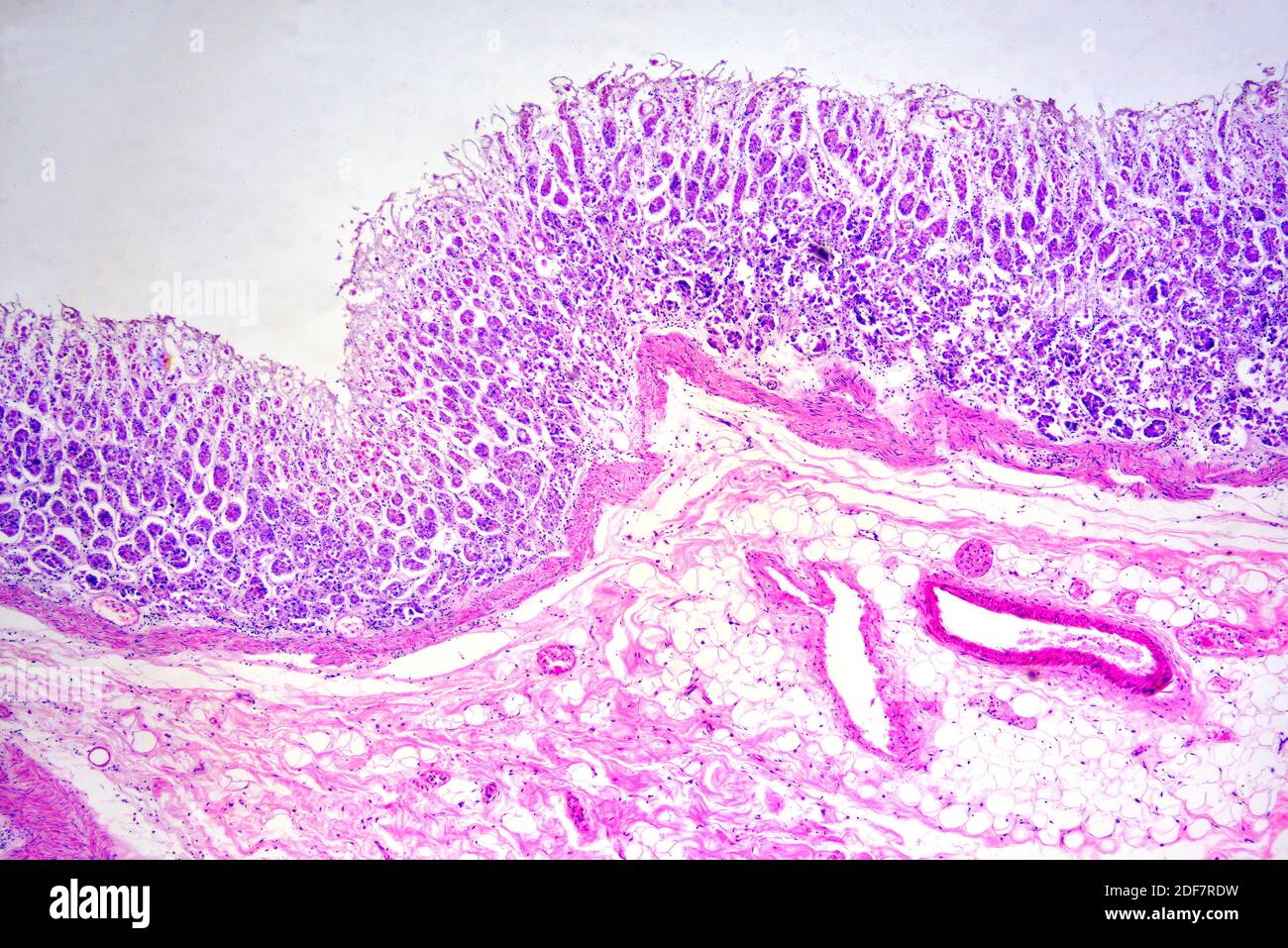 Fundus hi-res stock photography and images - Alamy