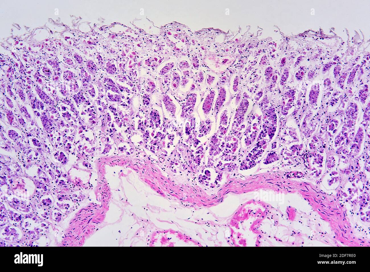 Fundus hi-res stock photography and images - Alamy