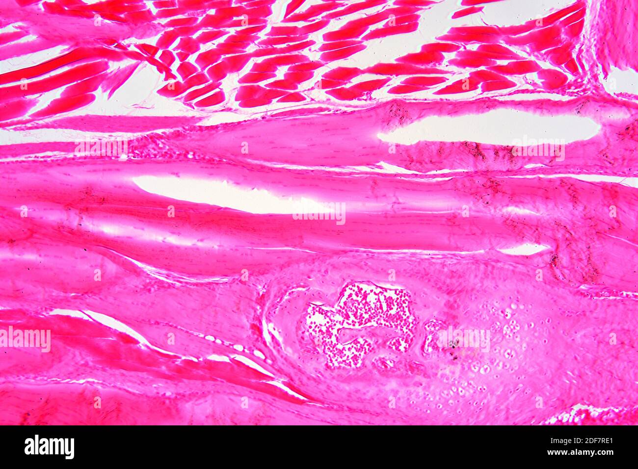 Human fibroblasts (fibrillar black structures). X75 at 10 cm wide Stock ...