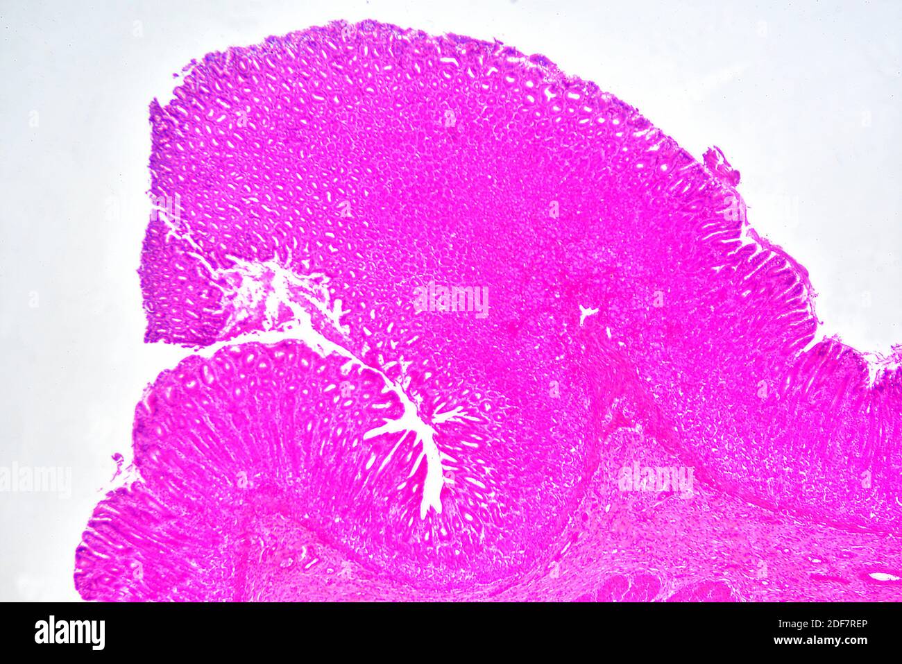 Cardia region hi-res stock photography and images - Alamy