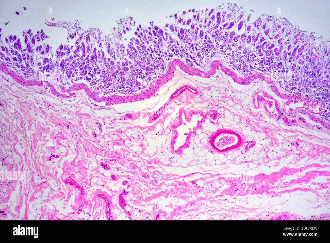 Gastric Fundus And Duodenum