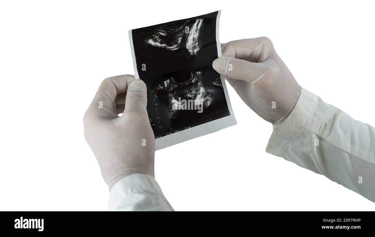 Ultrasound of male prostate isolated on white background, close-up ...
