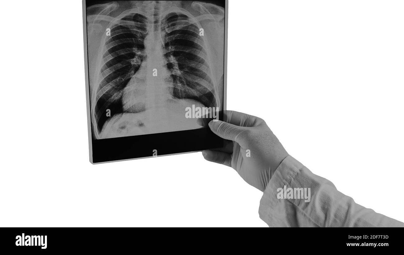 X ray white background Black and White Stock Photos & Images - Alamy