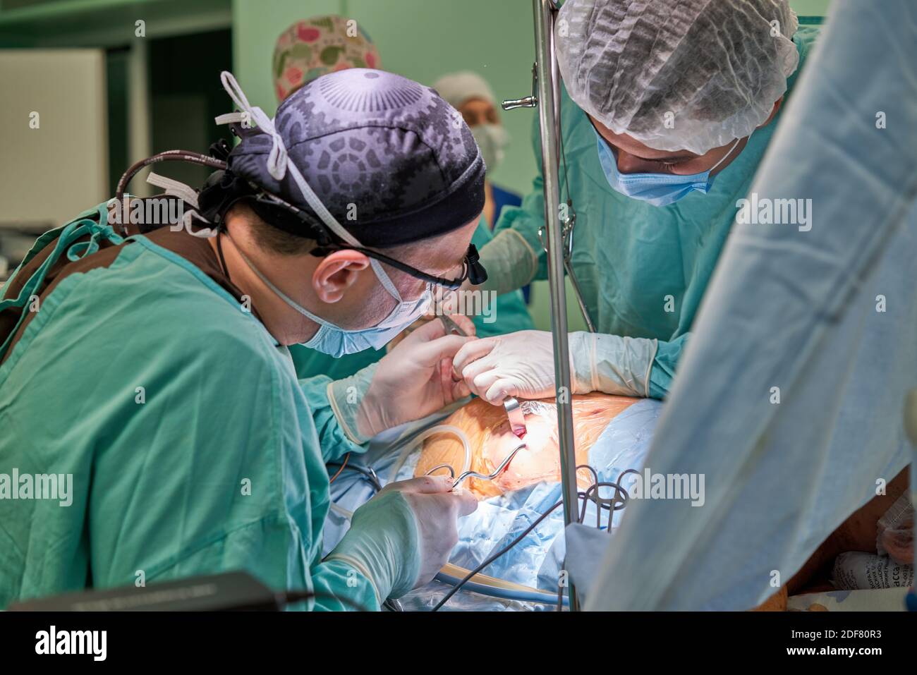 Surgeon Inserting Tube Into Patient During Surgery Stock Photo - Alamy