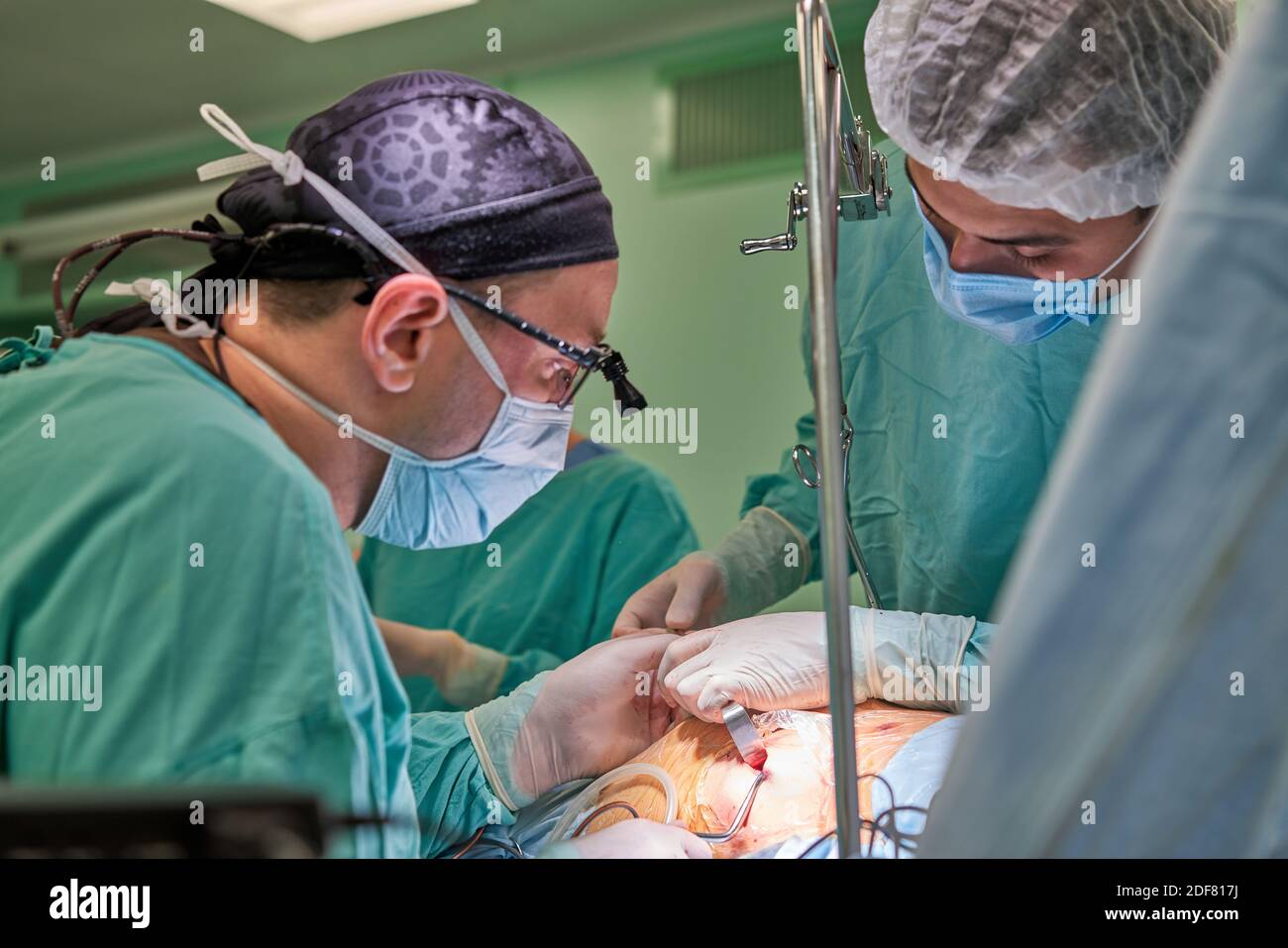 Surgeon Inserting Tube Into Patient During Surgery Stock Photo - Alamy