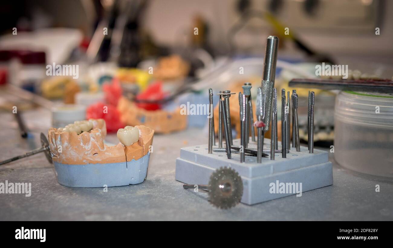 Ceramic crown of a tooth on a plaster model of teeth,the work of a ...