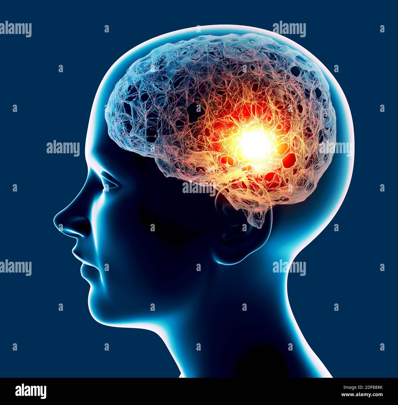 Pain in the head, brain and synapses, cognitive problems, mental ...