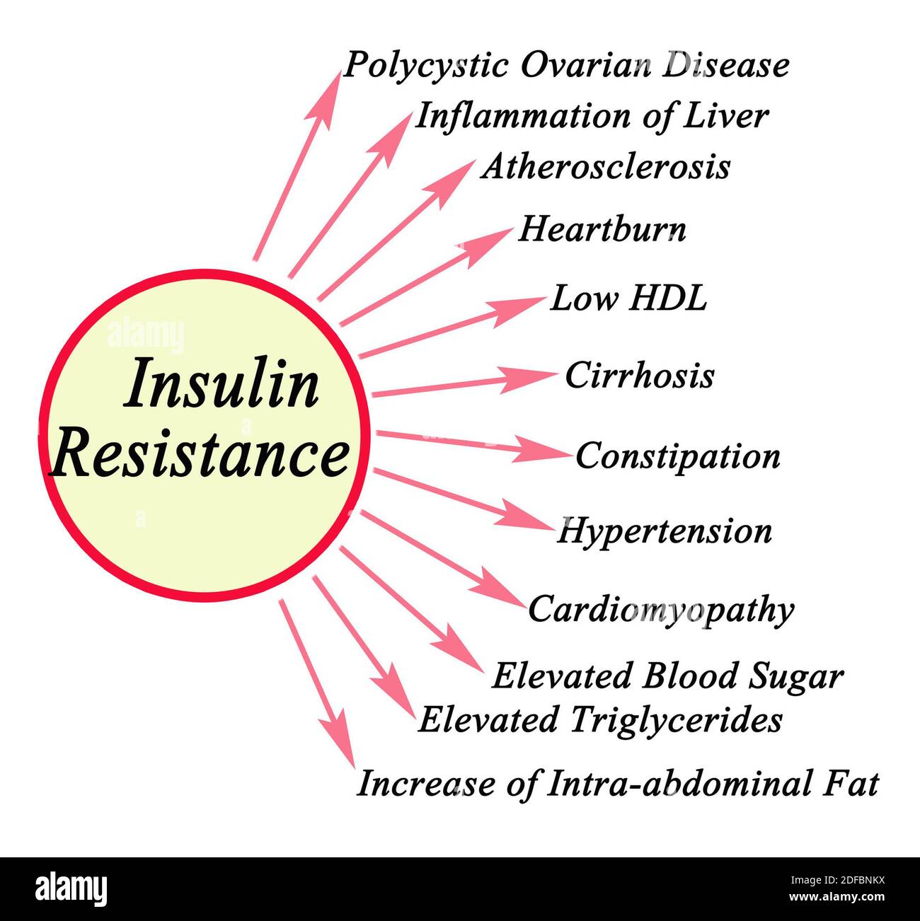 Twelve Consequences of Insulin Resistance Stock Photo - Alamy
