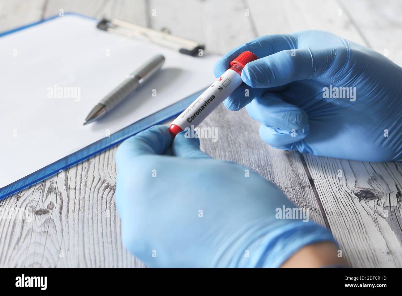 laboratory technician hand holding blood test tube and writing on paper ...