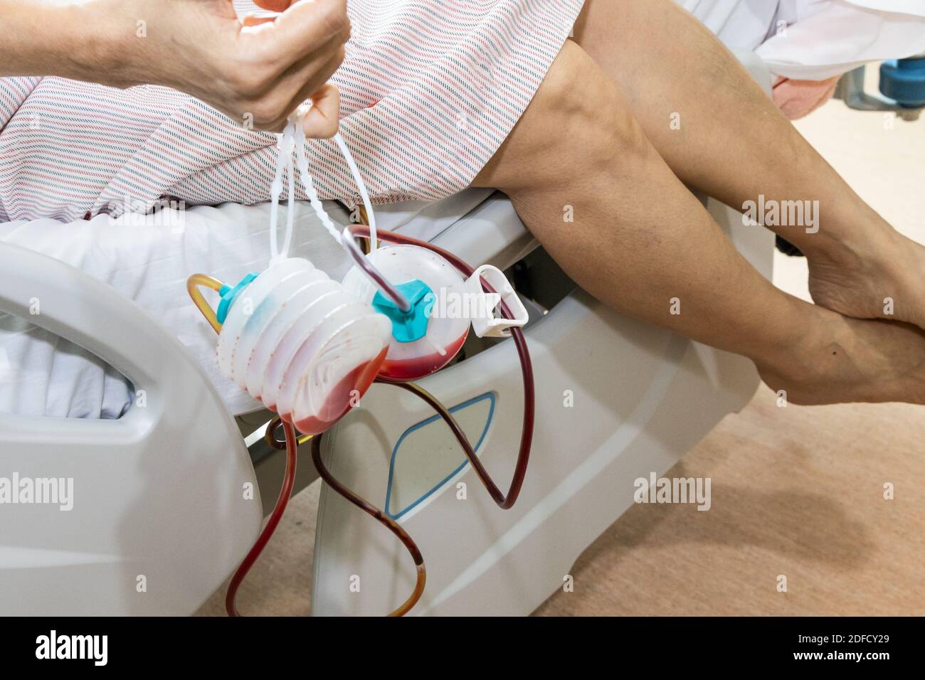 How Surgical Drainage Works at Christopher Lewis blog