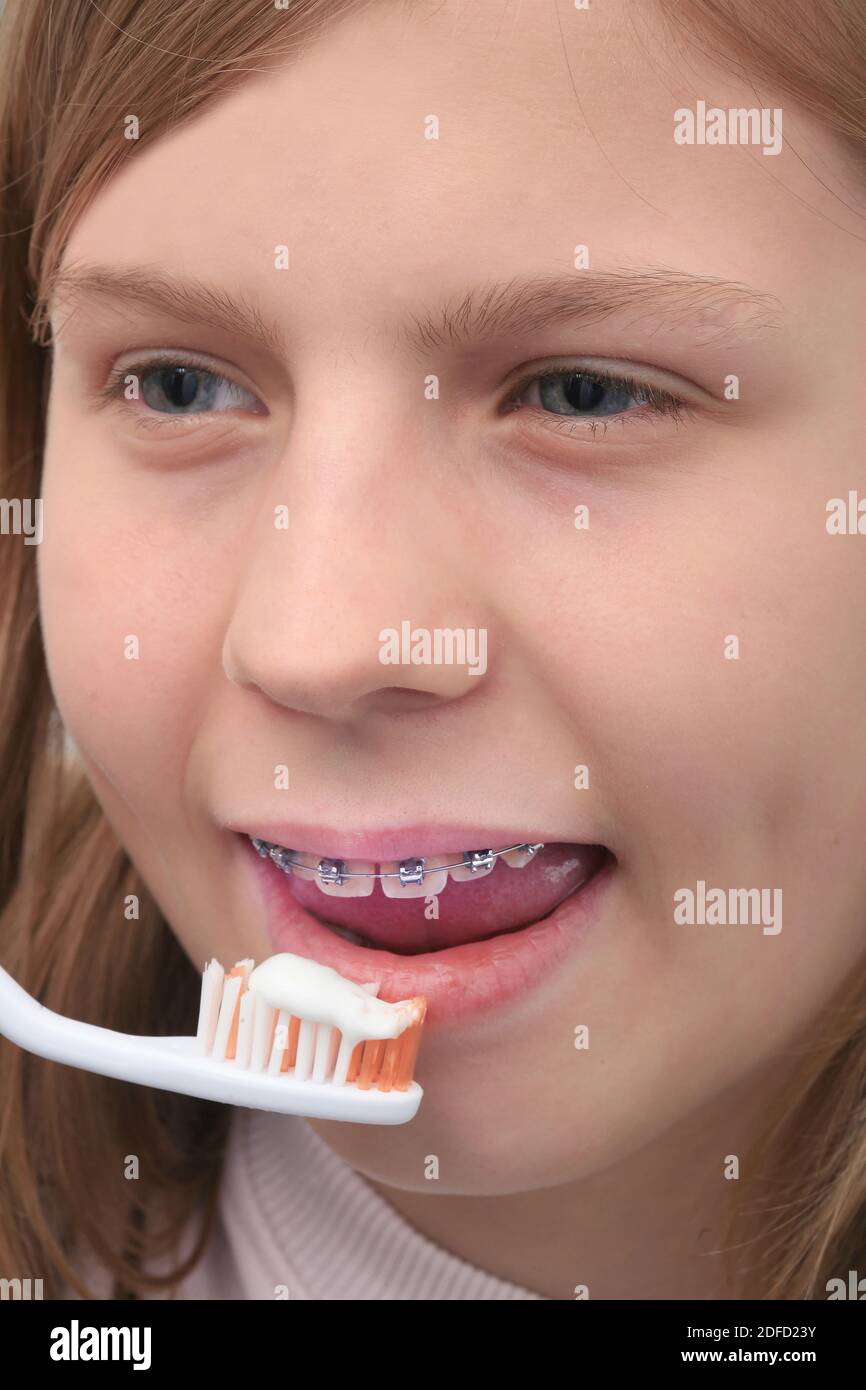 Girls with braces hi-res stock photography and images - Alamy