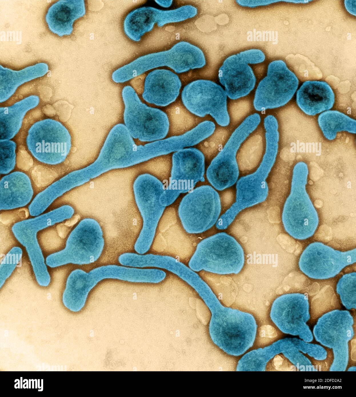 Colorized transmission electron micrograph of Marburg virus particles ...