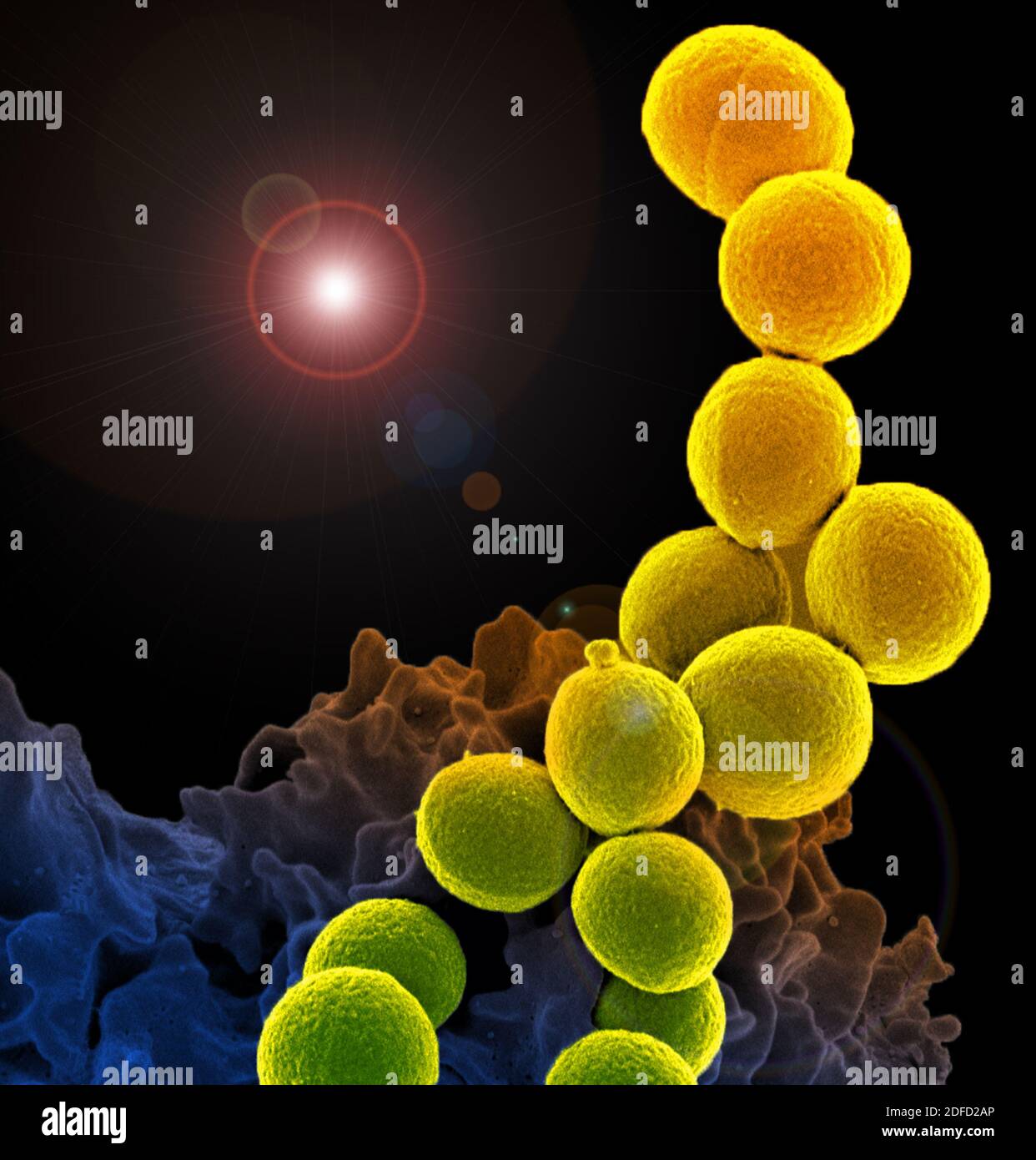Colorized scanning electron micrograph of a white blood cell ...