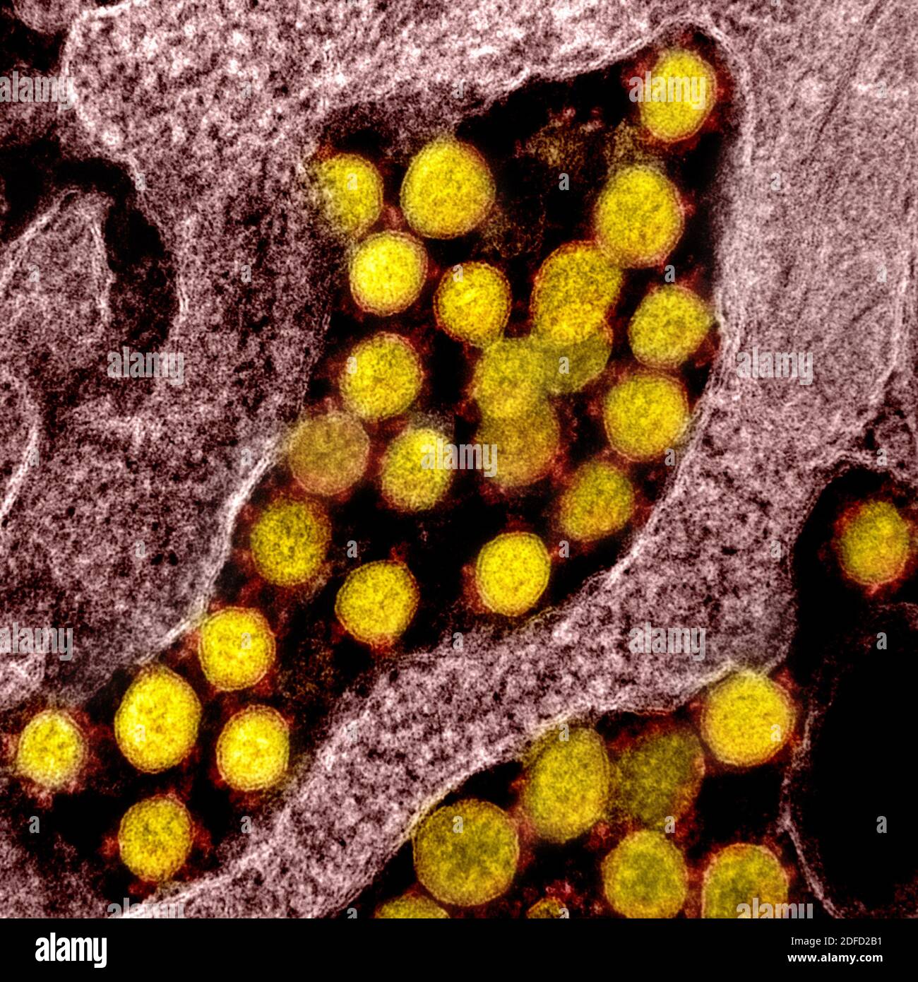 Electron Microscope Images Color Virus