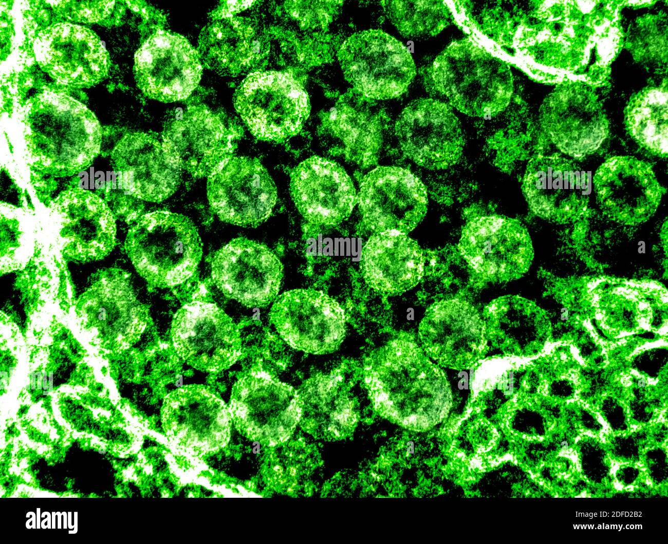 Transmission electron microscope color enhanced hi-res stock ...