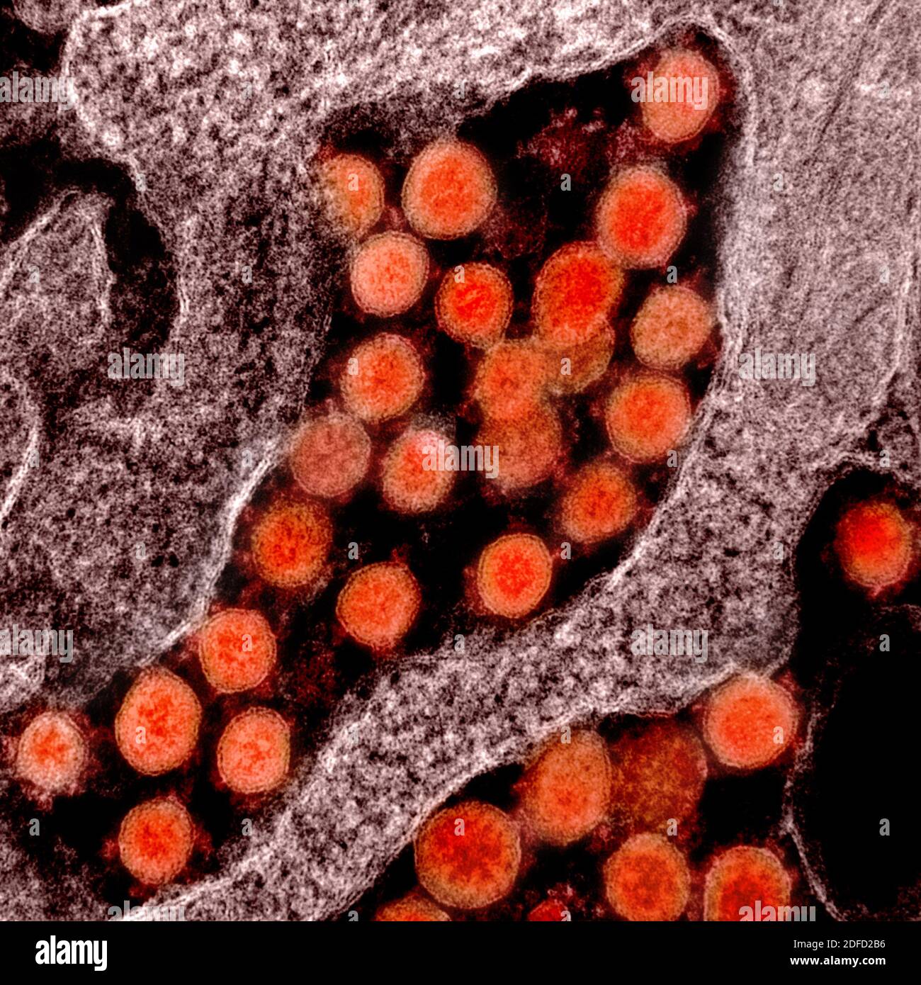 Transmission electron microscope color enhanced hi-res stock ...