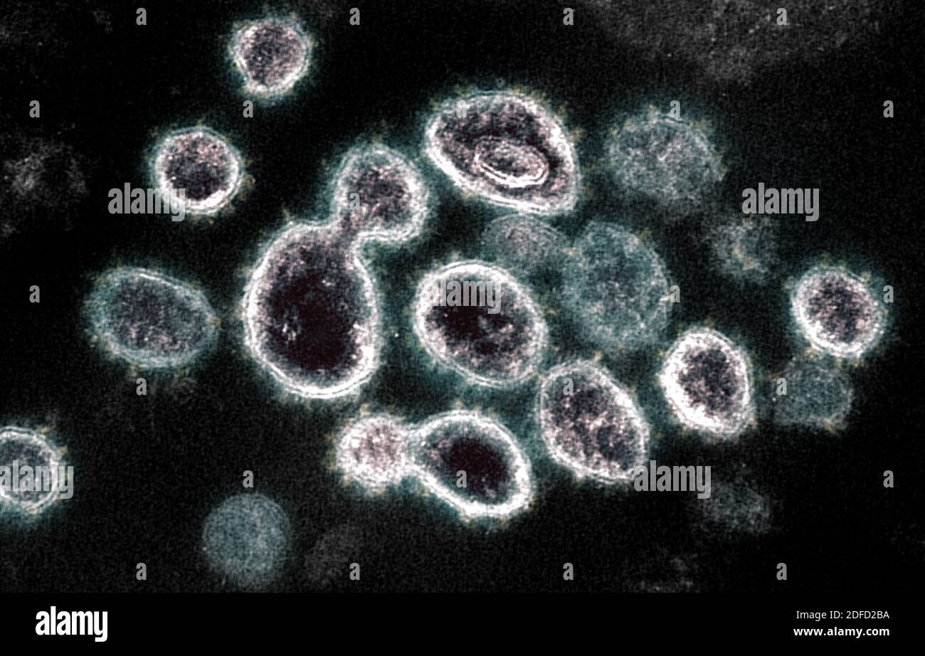 This transmission electron microscope image shows SARS-CoV-2, the virus ...