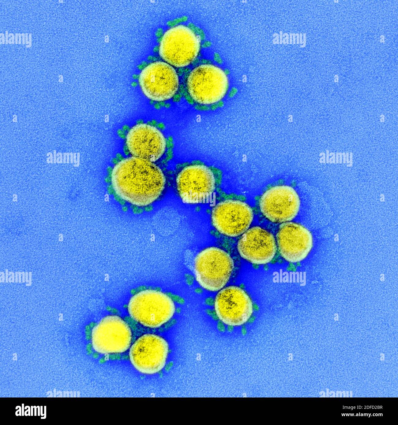 Transmission electron microscope color enhanced hi-res stock ...