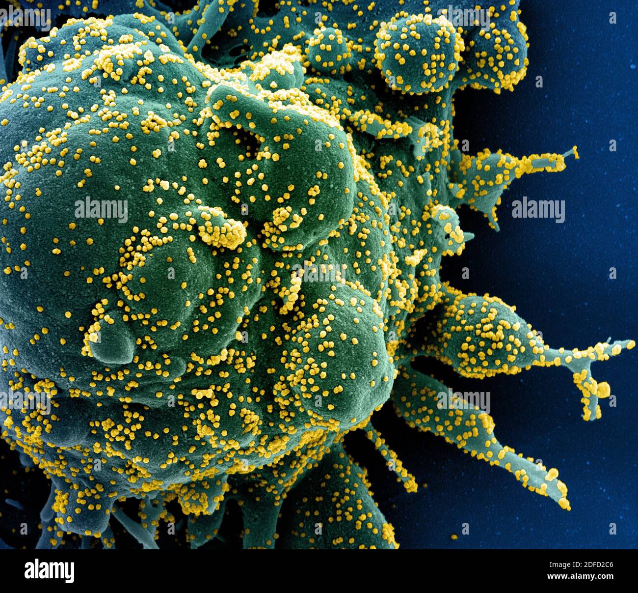 Apoptotic cell electron micrograph hi-res stock photography and images ...