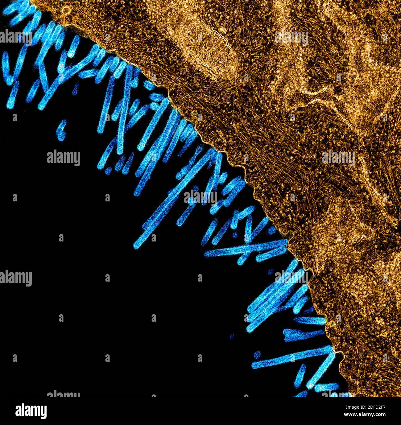 Colorized transmission electron micrograph of SW31 (swine strain ...