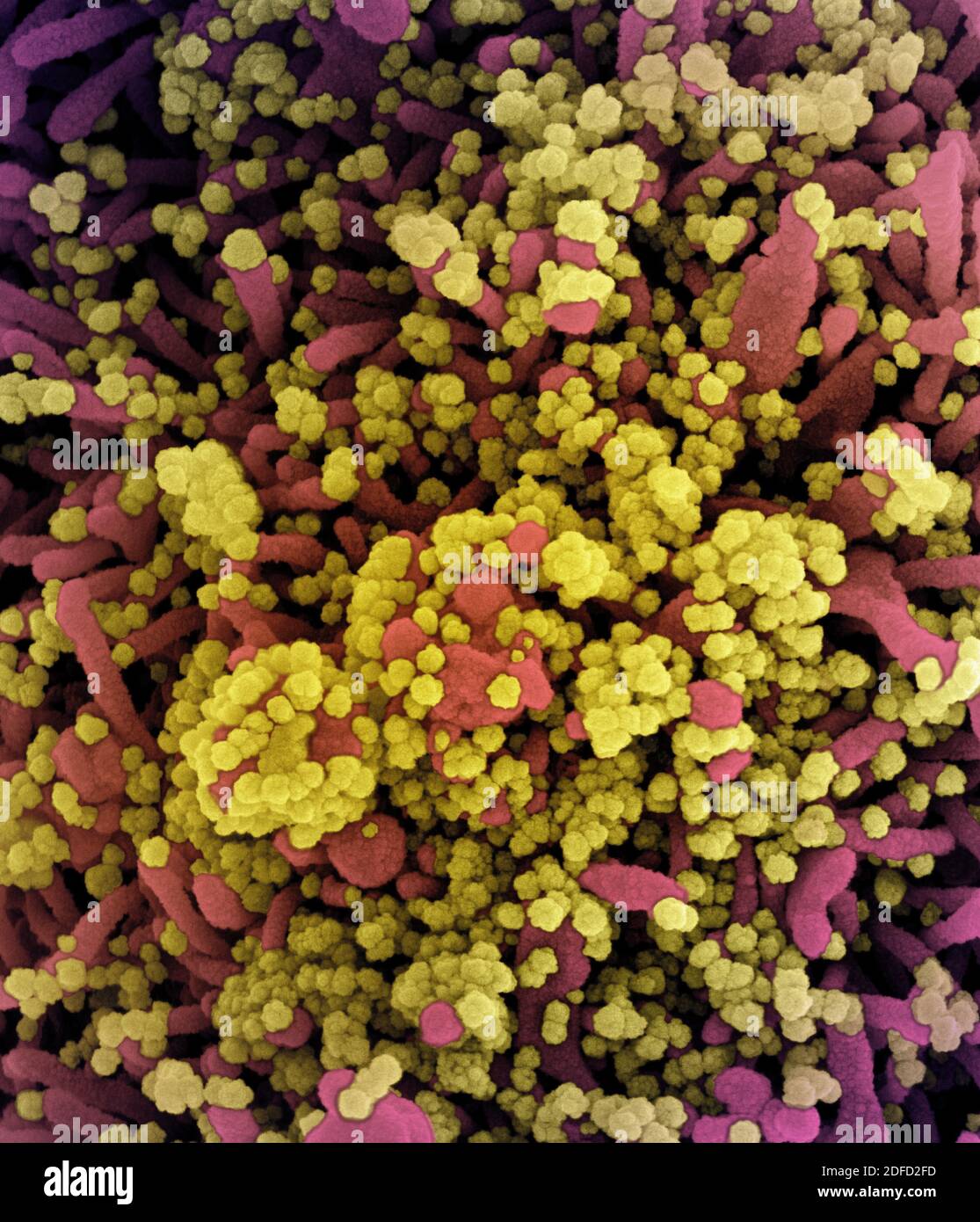 Colorized scanning electron micrograph of a cell heavily infected with ...