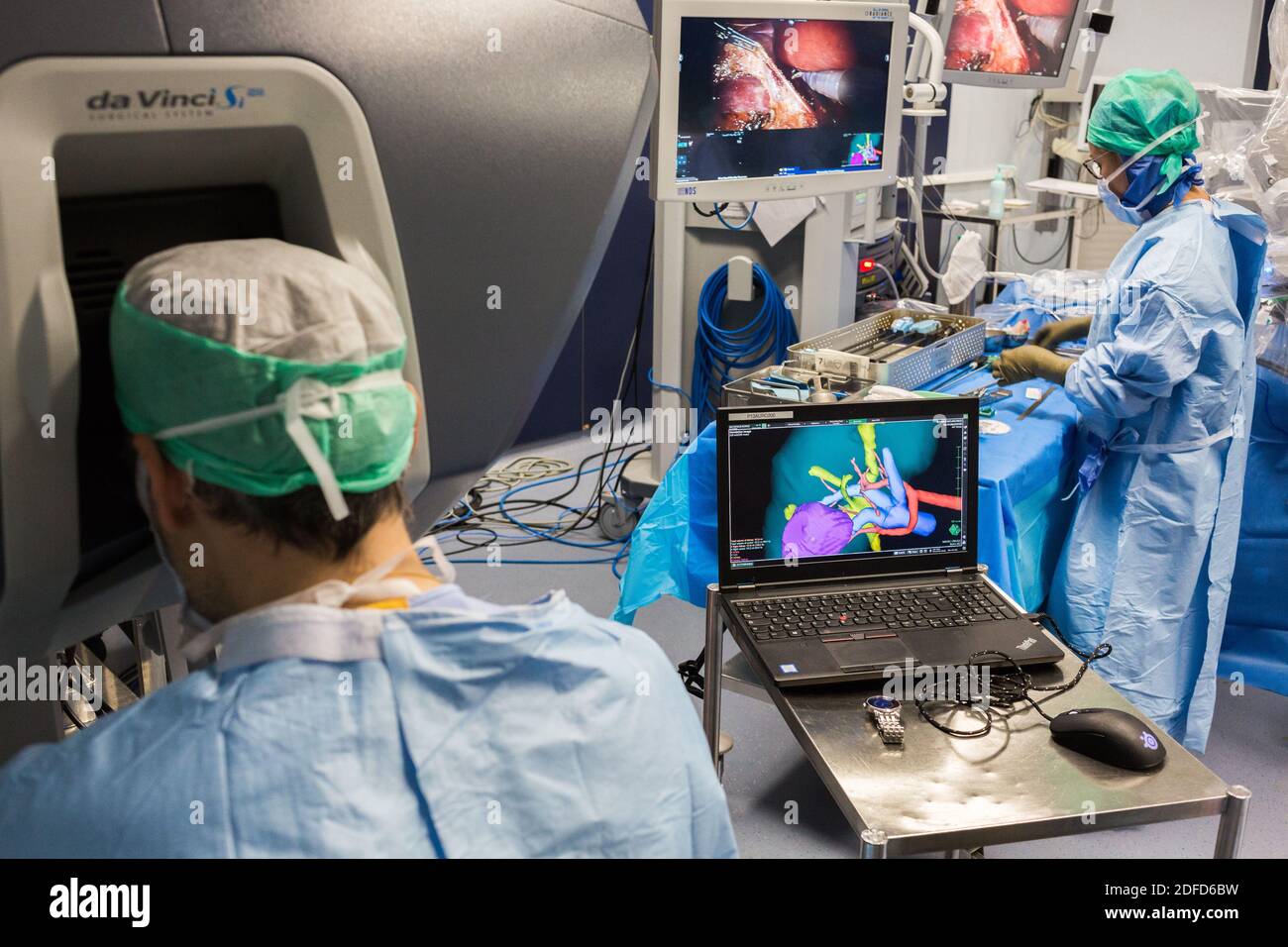 Image-guided robotic conservative renal surgery assisted by 3D modeling ...
