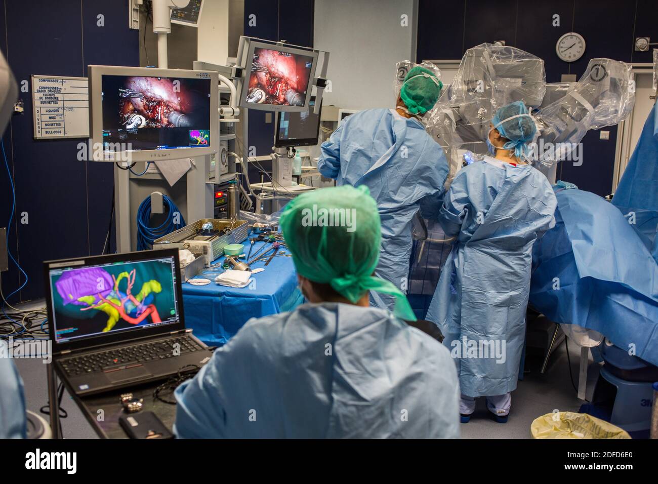 Image-guided robotic conservative renal surgery assisted by 3D modeling ...