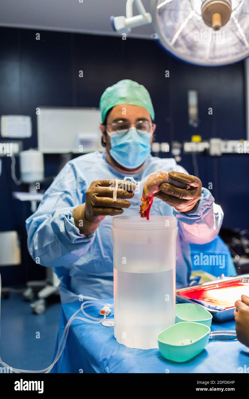 Kidney removal by laparoscopy from a living related donor, the surgeon ...