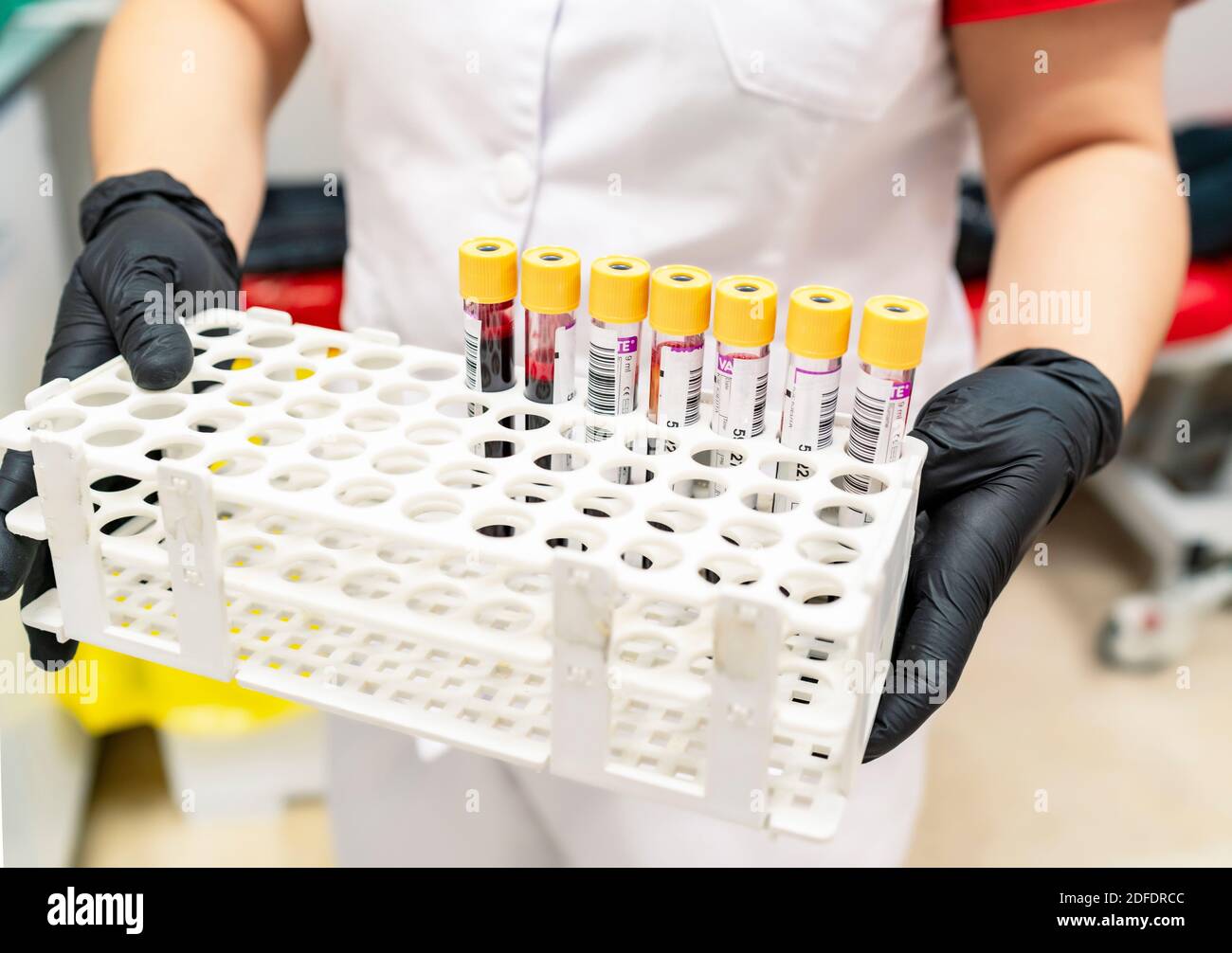 Doctor putting tubes blood hi-res stock photography and images - Alamy